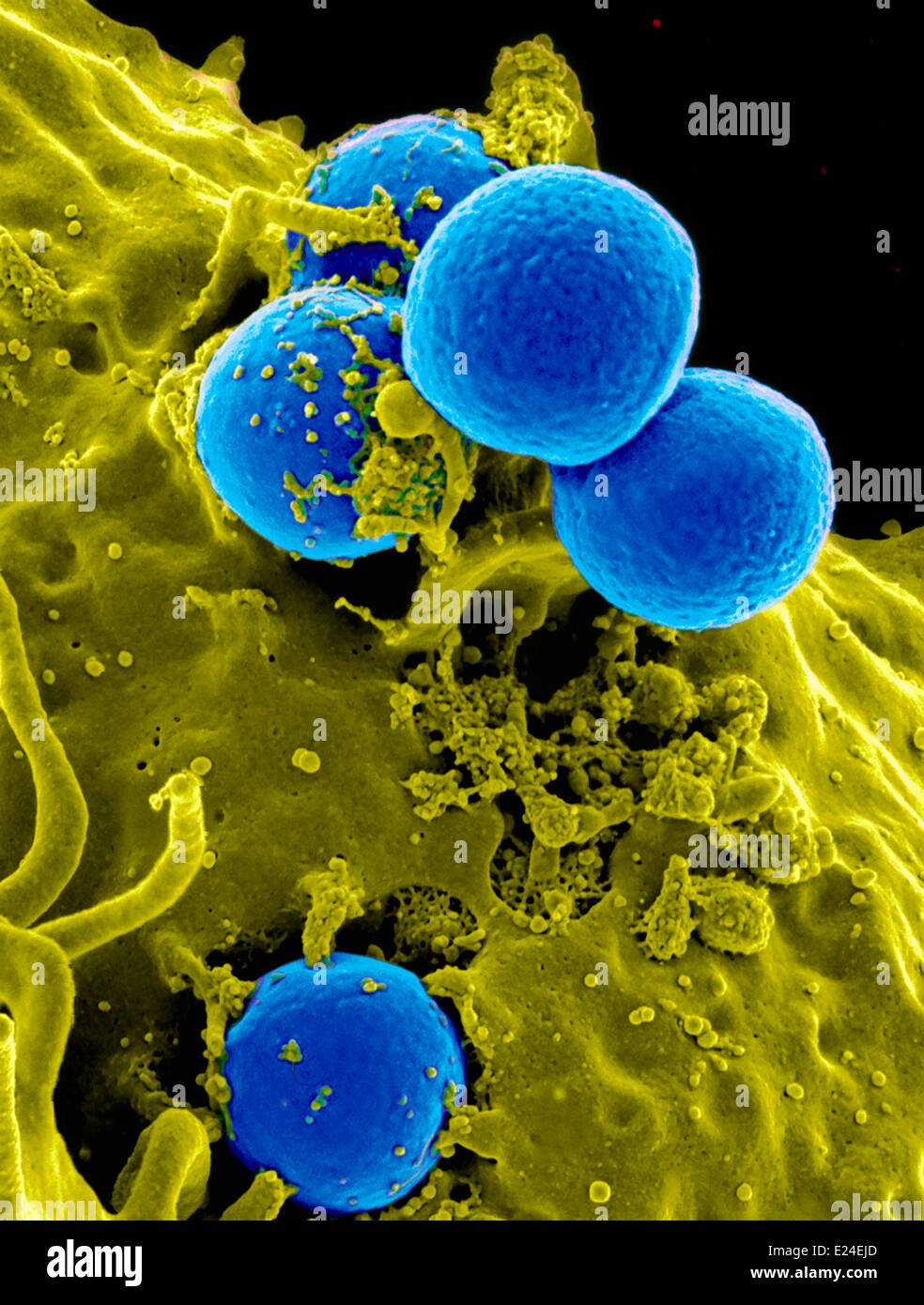 Mrsa microscope Banque de photographies et d’images à haute résolution ...