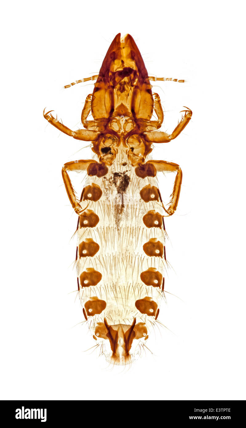 Morsure insecte oiseau microscope arthropode tique emu ecto parasite ...