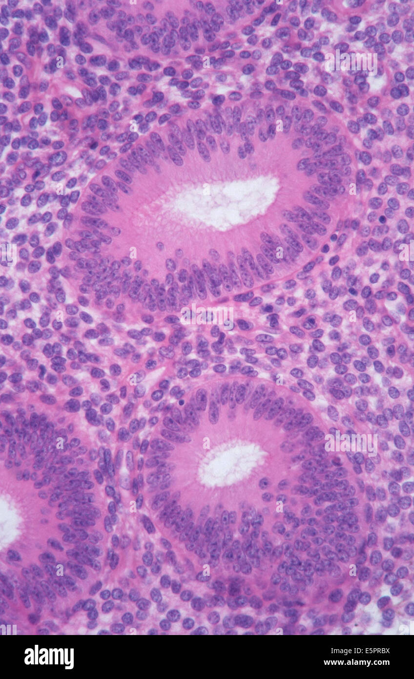Les cellules de l'endomètre normal, la microscopie Photo Stock - Alamy
