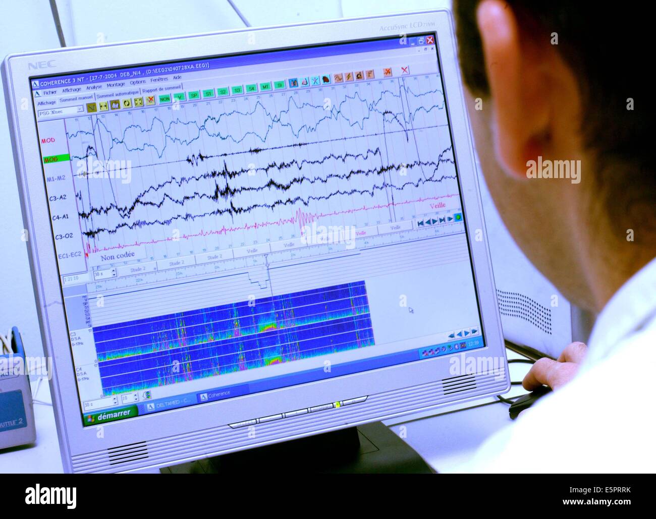 Examen polysomnographique Banque de photographies et d’images à haute ...