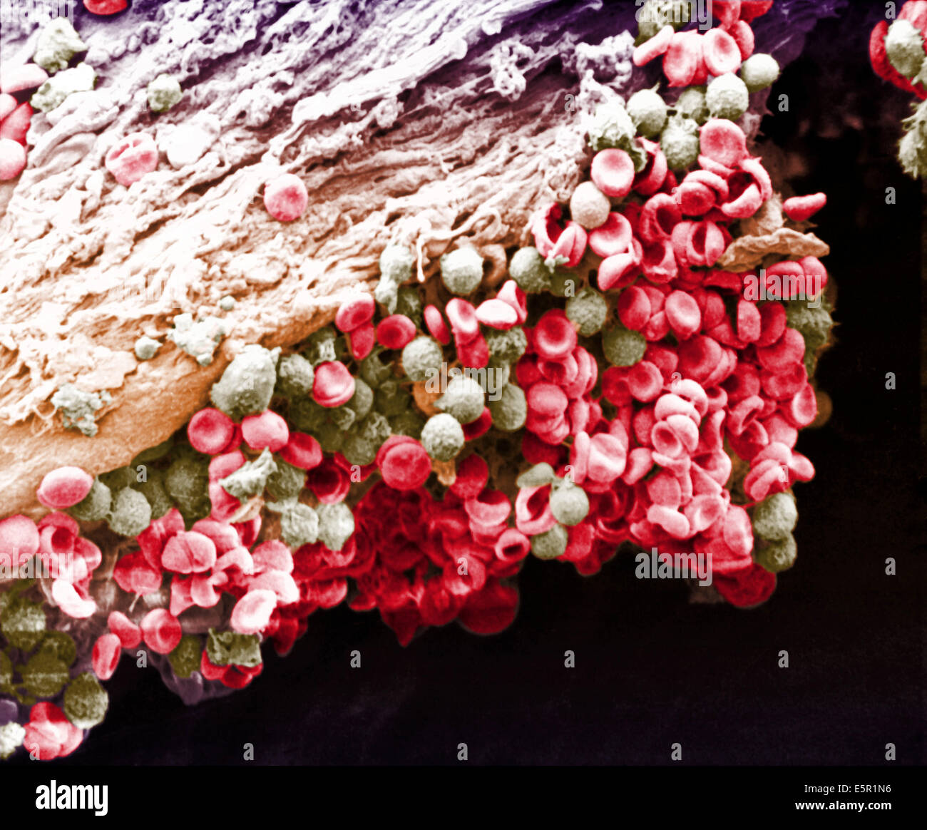 L'analyse des électrons Microphotographie (SEM) d'agglutination des ...