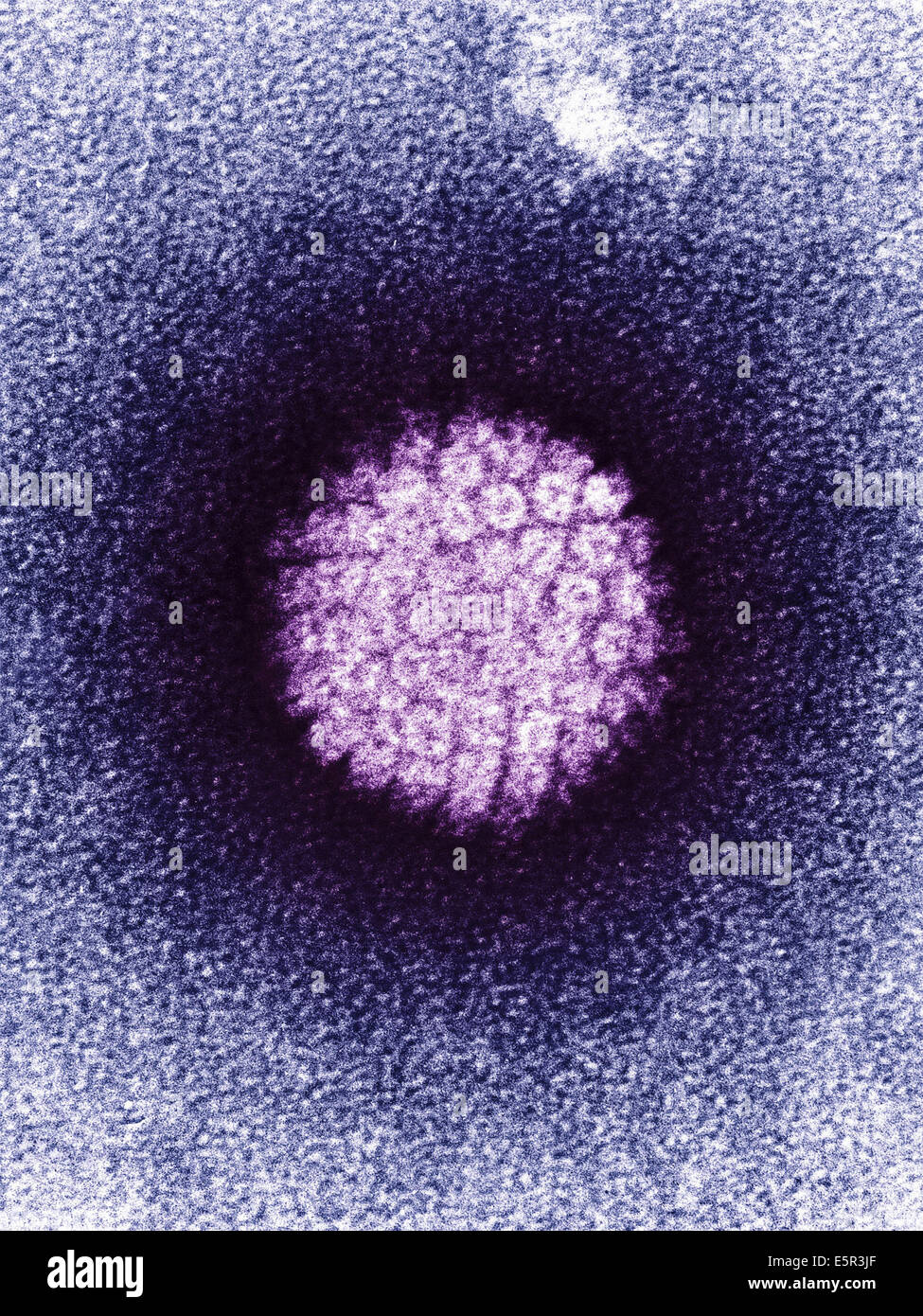 Papilloma virus Banque de photographies et d’images à haute résolution ...