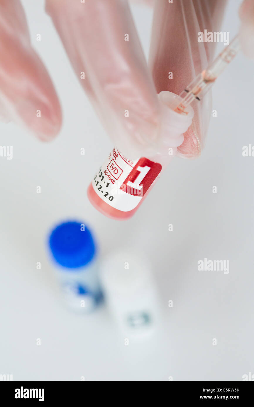 Hiv testing Banque de photographies et d’images à haute résolution - Alamy