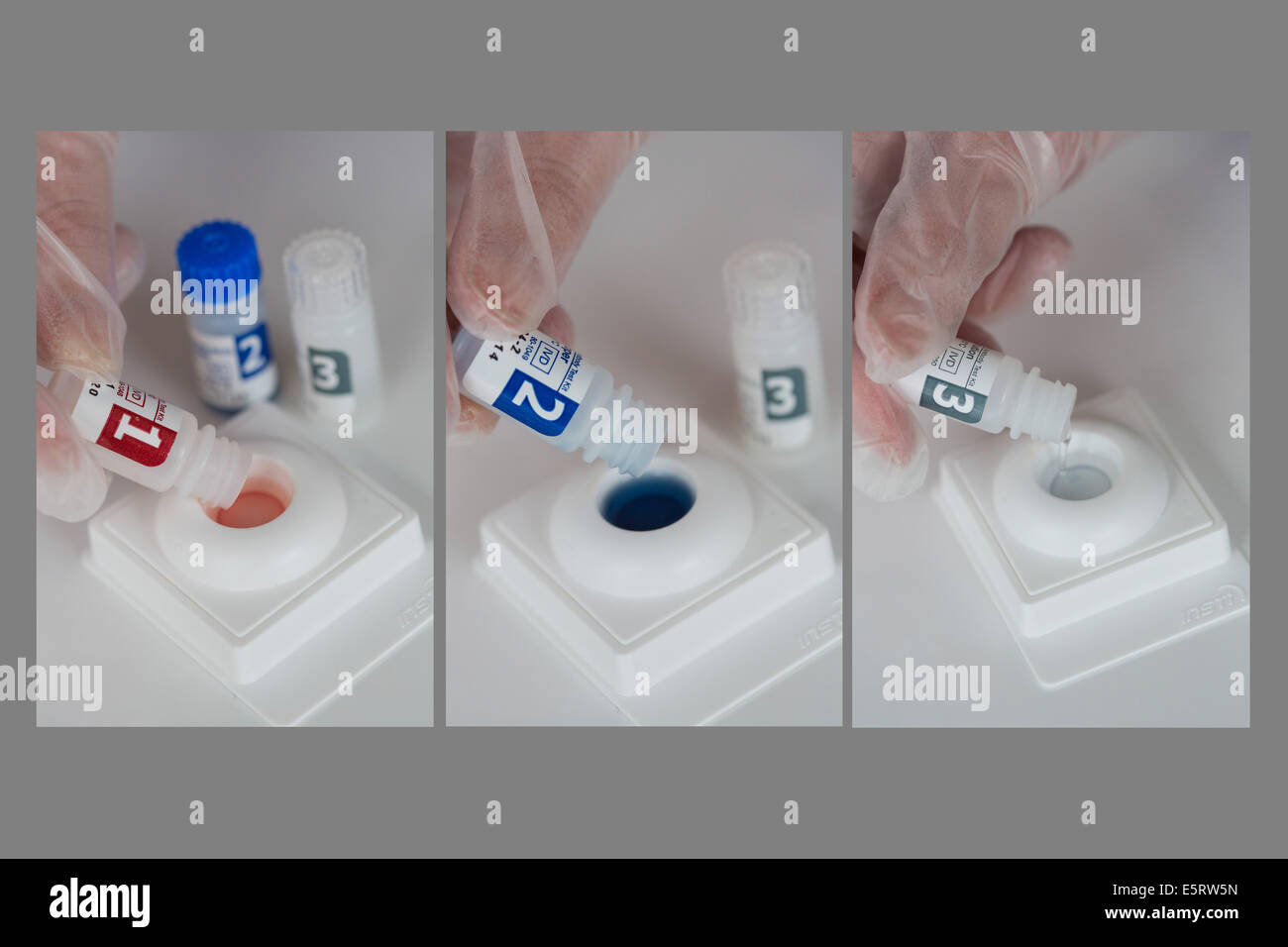 Maladie sexuellement transmissible vih Banque de photographies et d ...