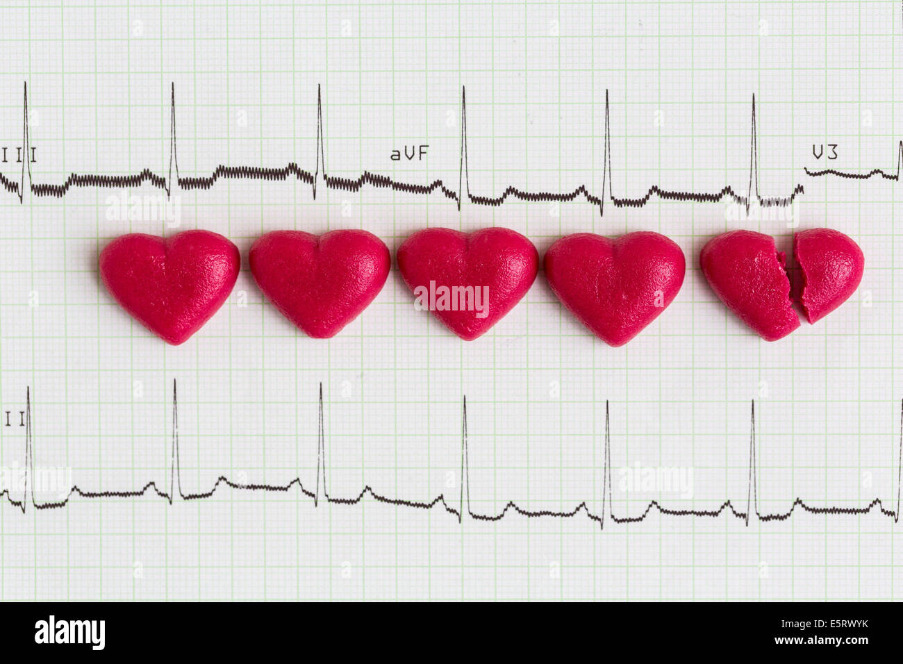 Electrocardiograma ecg Banque de photographies et d’images à haute ...