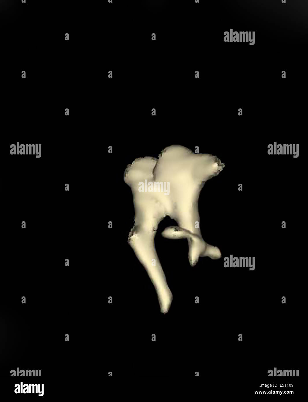 Oreille osselet marteau Banque de photographies et d’images à haute ...