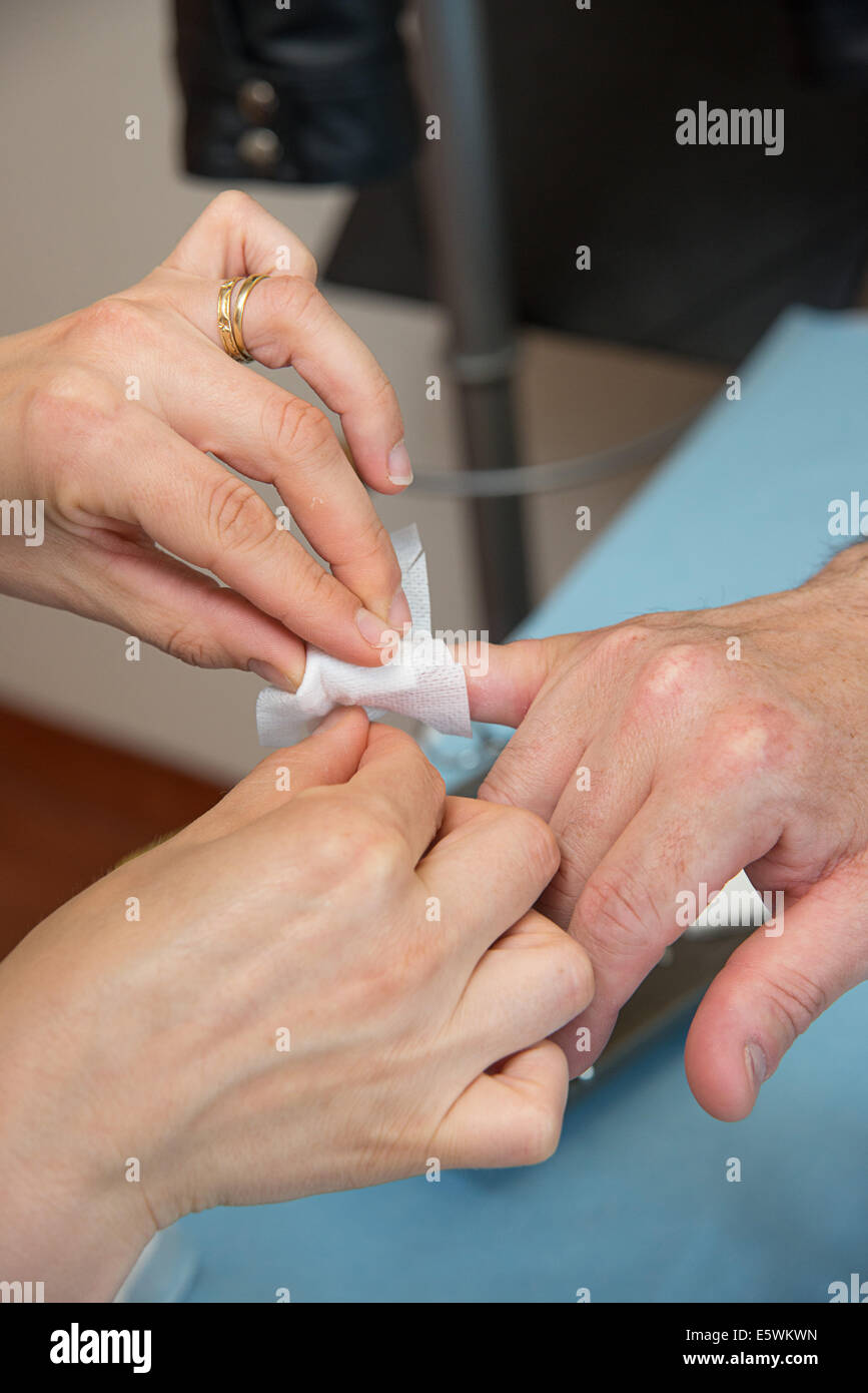 Panaris doigt main Banque de photographies et d’images à haute ...