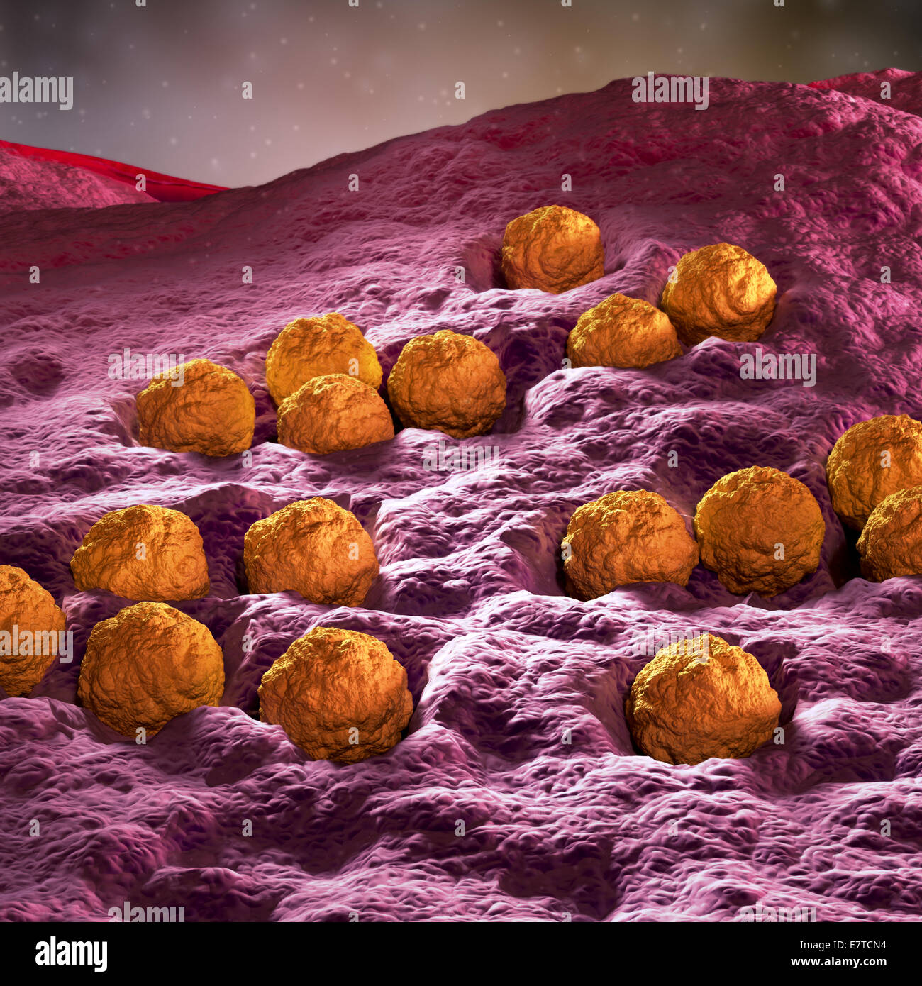 German measles Banque de photographies et d’images à haute résolution ...