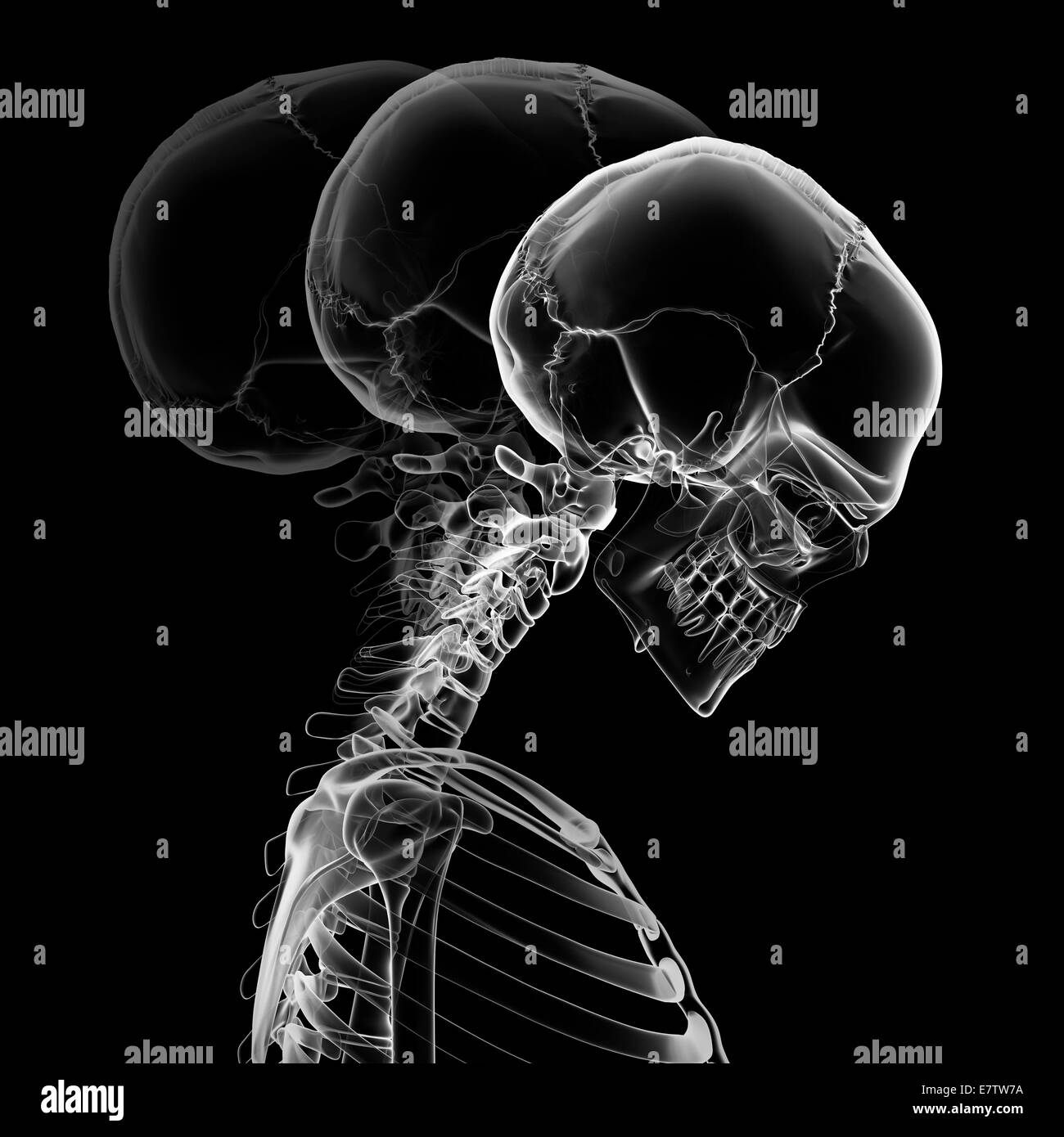 Anatomie du cou humain Banque d'images noir et blanc - Alamy