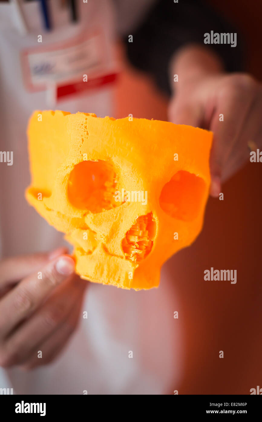 L'impression 3D du squelette du visage d'un patient à partir d'une ...