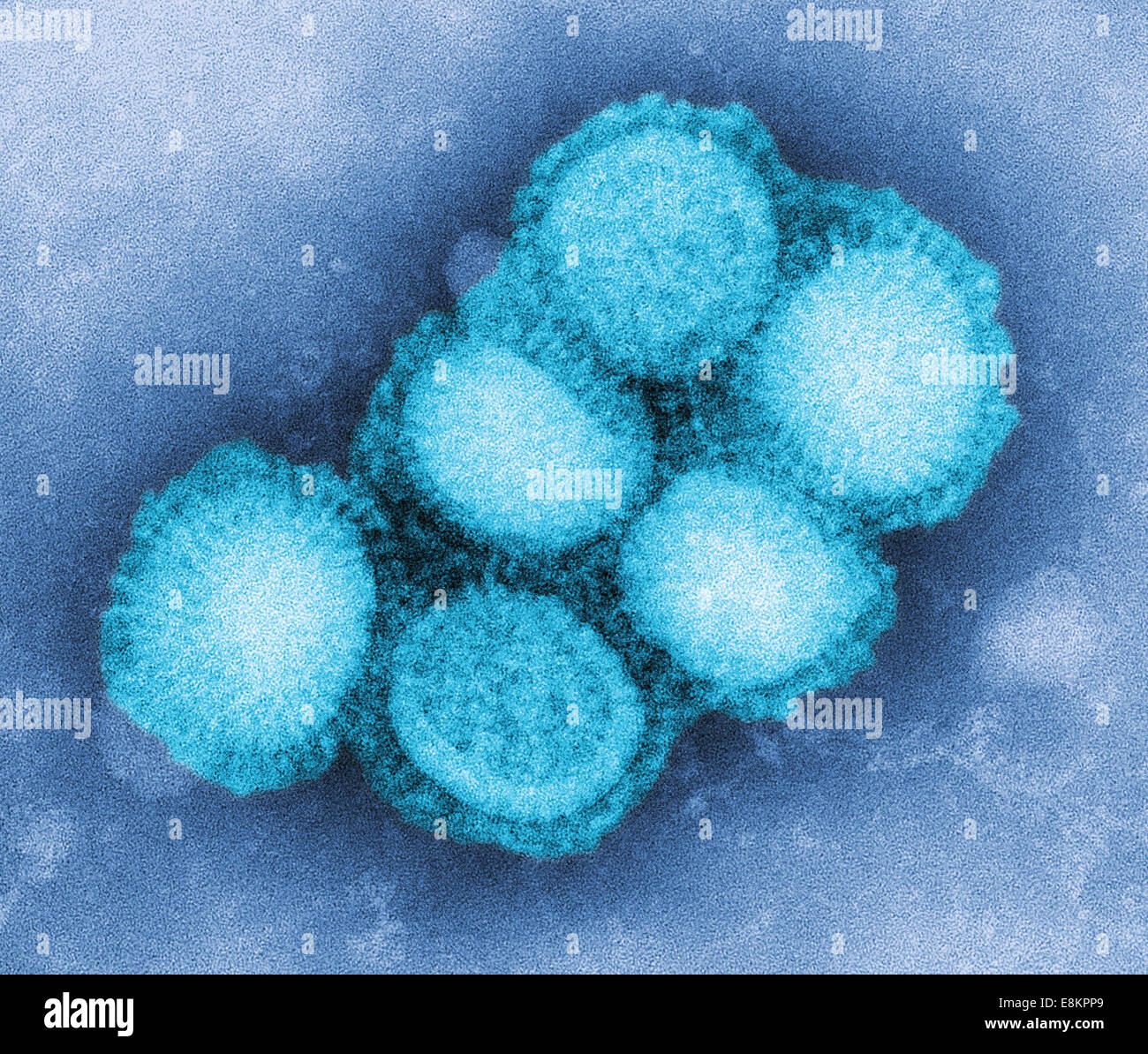 Micrographie électronique à transmission à coloration négative Banque ...