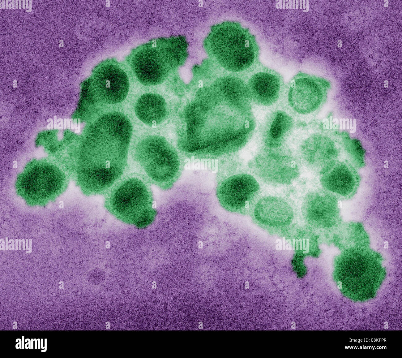Cette coloration négative colorisée micrographie électronique à ...