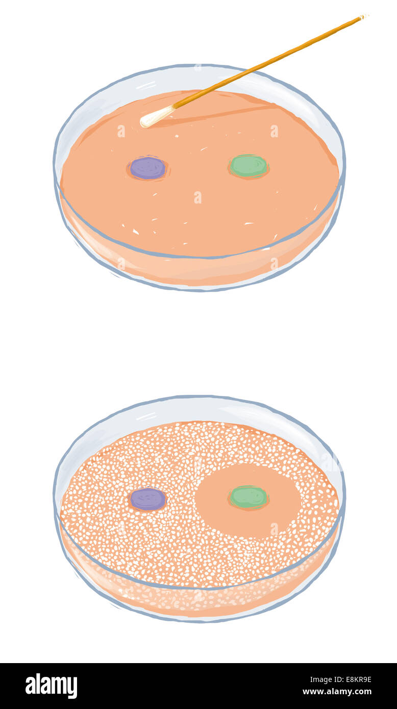 Antibiogramme qui teste la sensibilité des bactéries aux antibiotiques ...