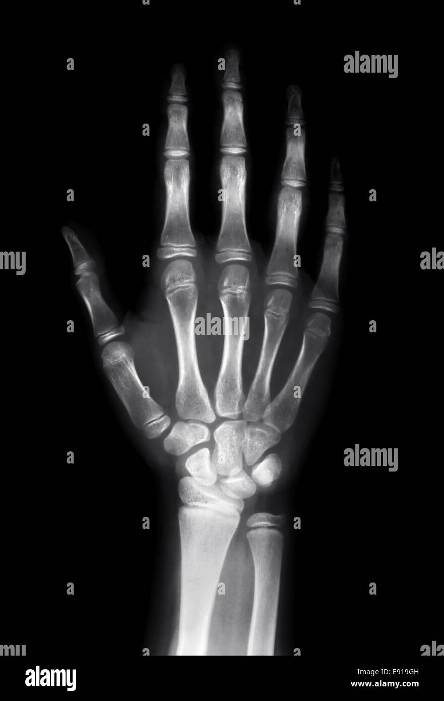 Anatomie de la main humaine Banque de photographies et d’images à haute ...