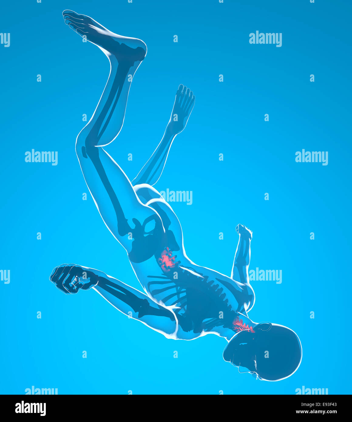 Radiografia de un cuerpo humano Banque de photographies et d’images à ...