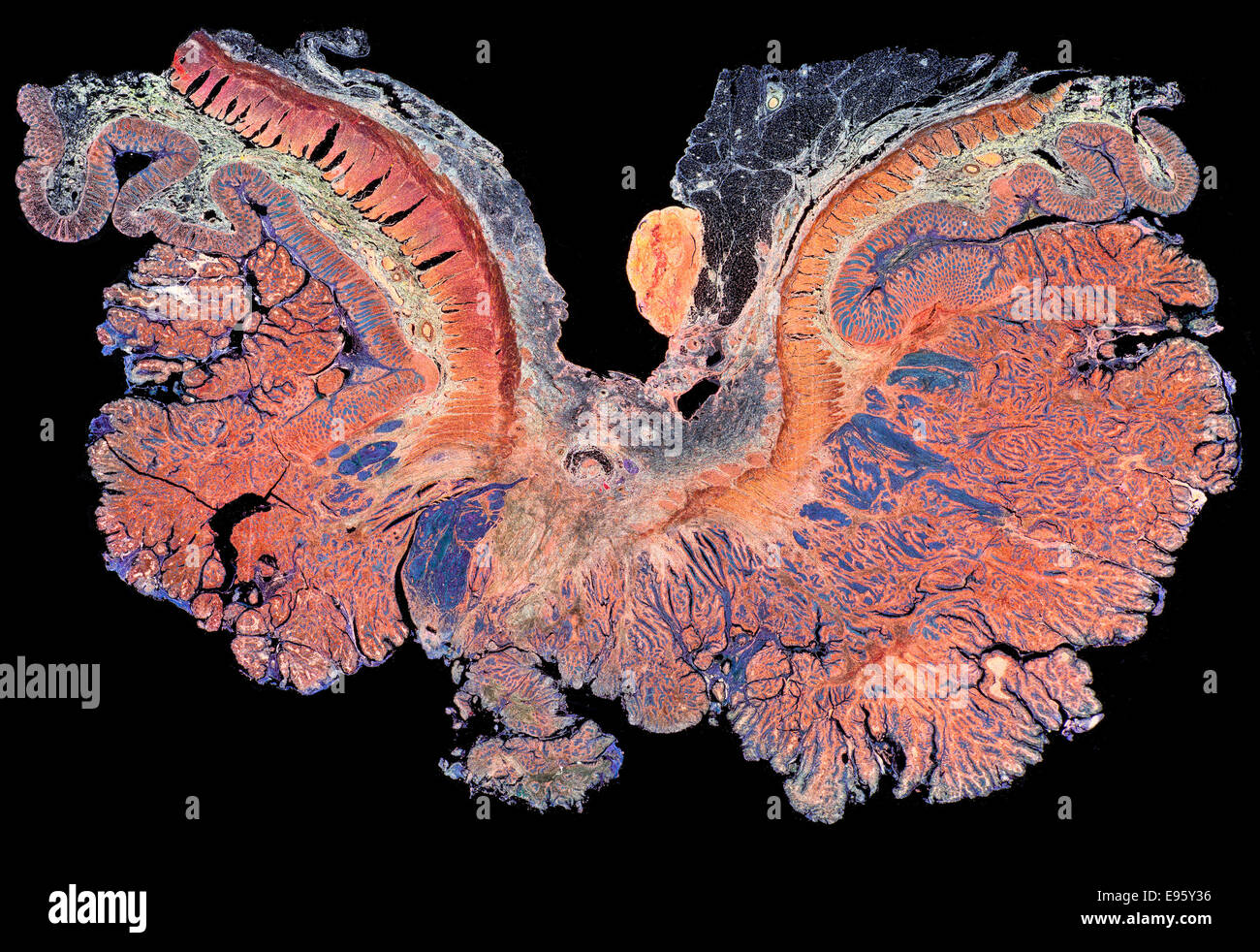 épithélium intestinal Banque de photographies et d’images à haute ...