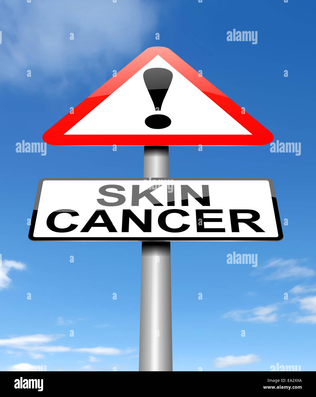 Malignant melanoma skin cancer Banque de photographies et d’images à haute résolution - Alamy