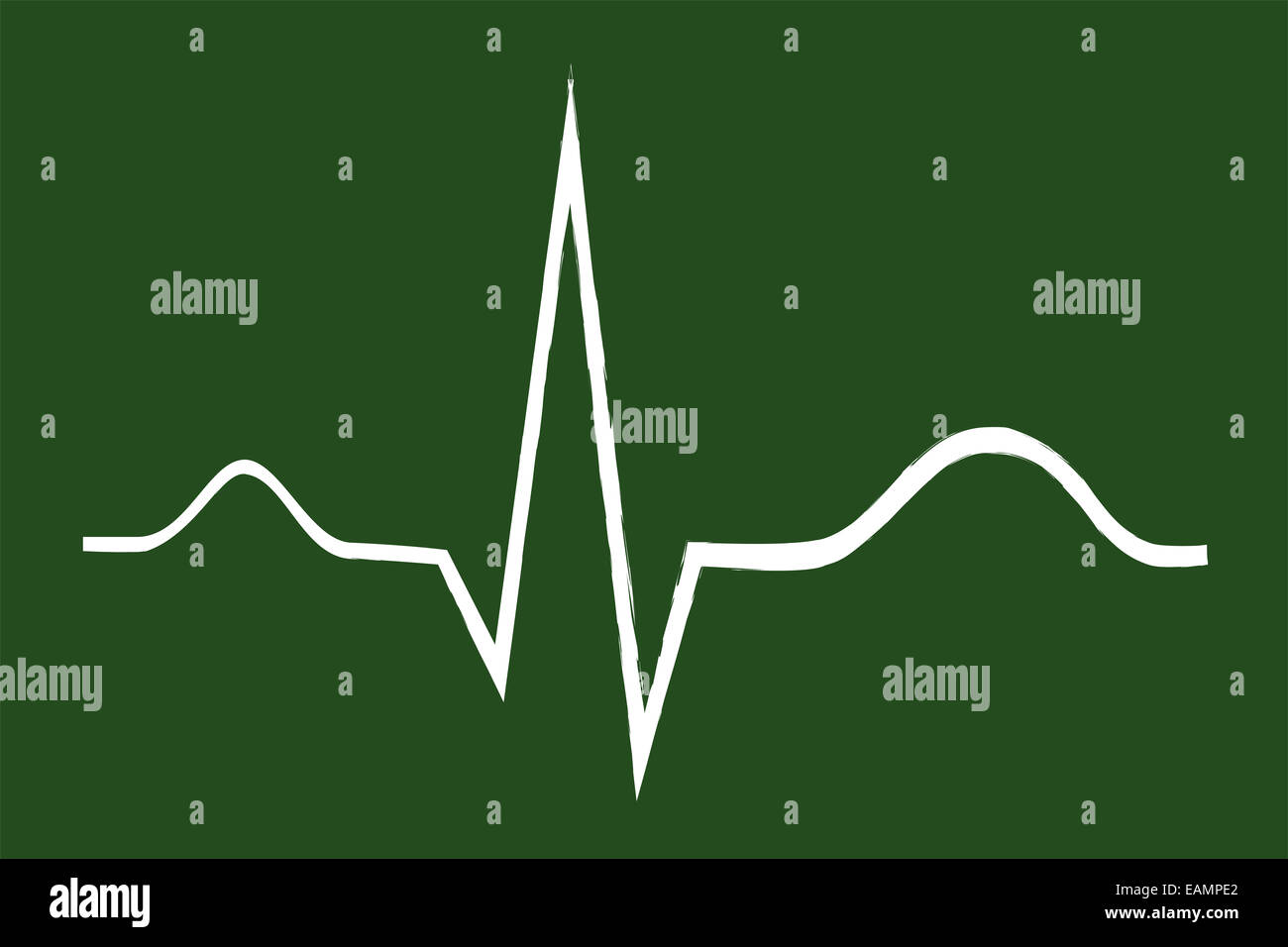 Électrocardiogramme normal expliqué Graphique sur tableau noir Photo ...