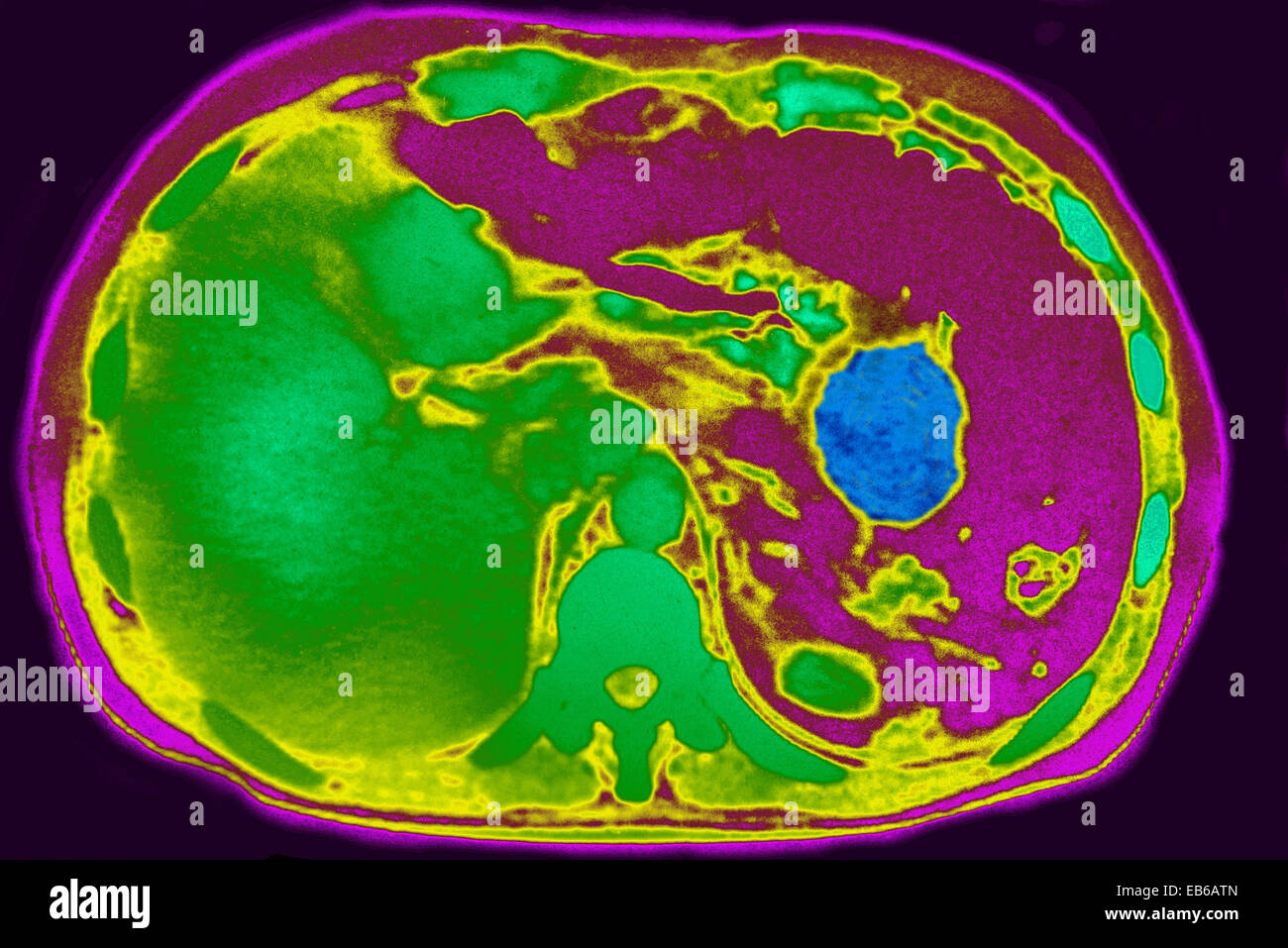 Ct scan scans Banque de photographies et d’images à haute résolution ...