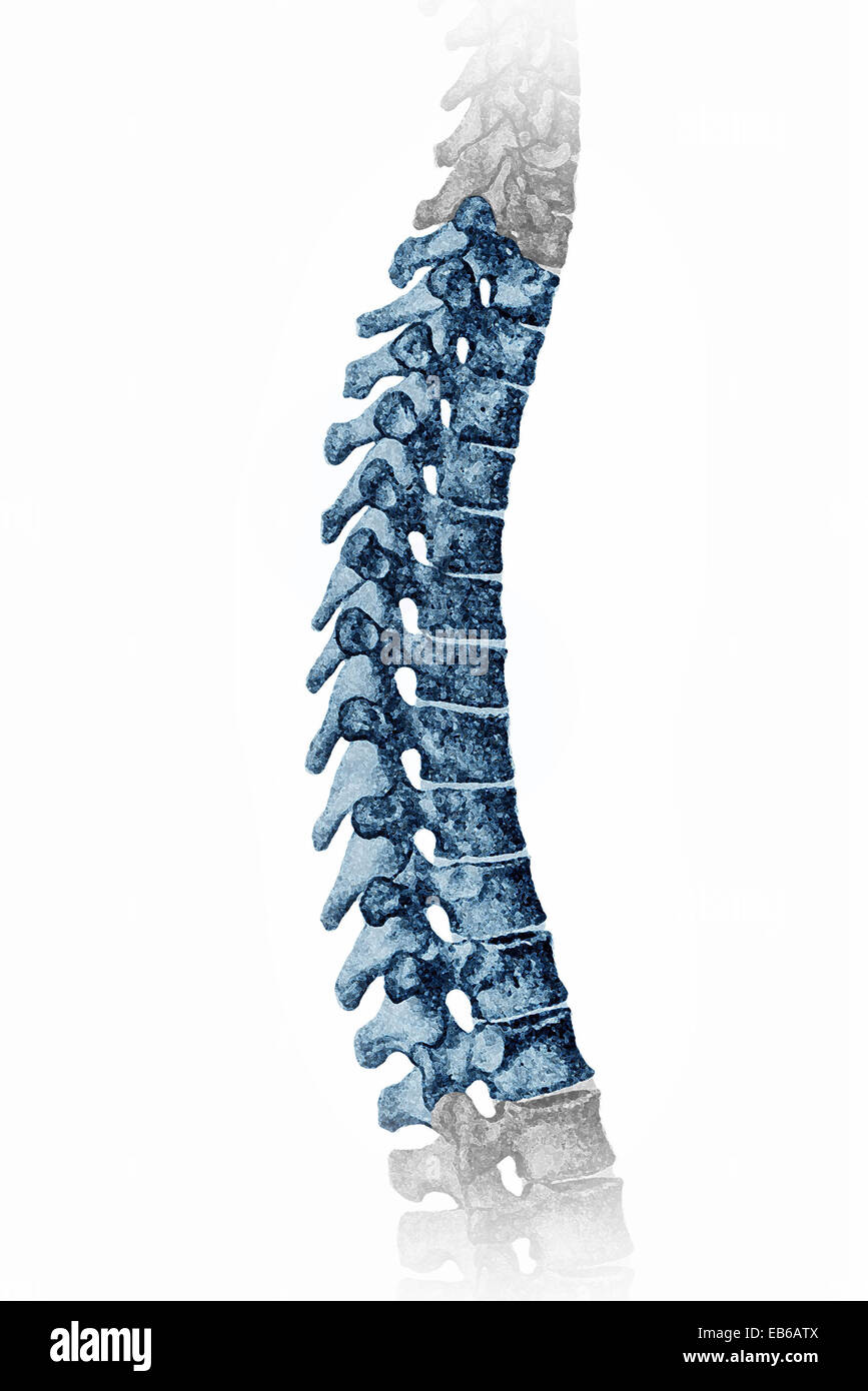 Ct de la colonne dorsal Banque d'images détourées - Alamy