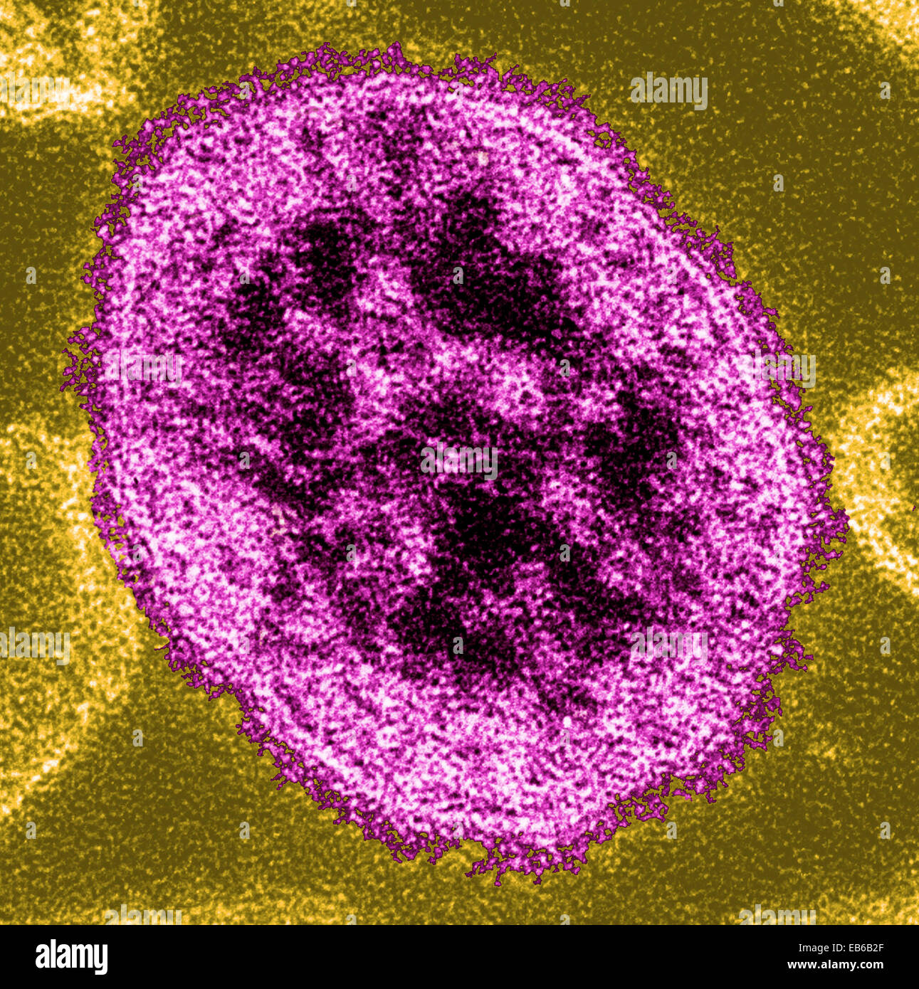 VIRUS DE LA ROUGEOLE Photo Stock - Alamy