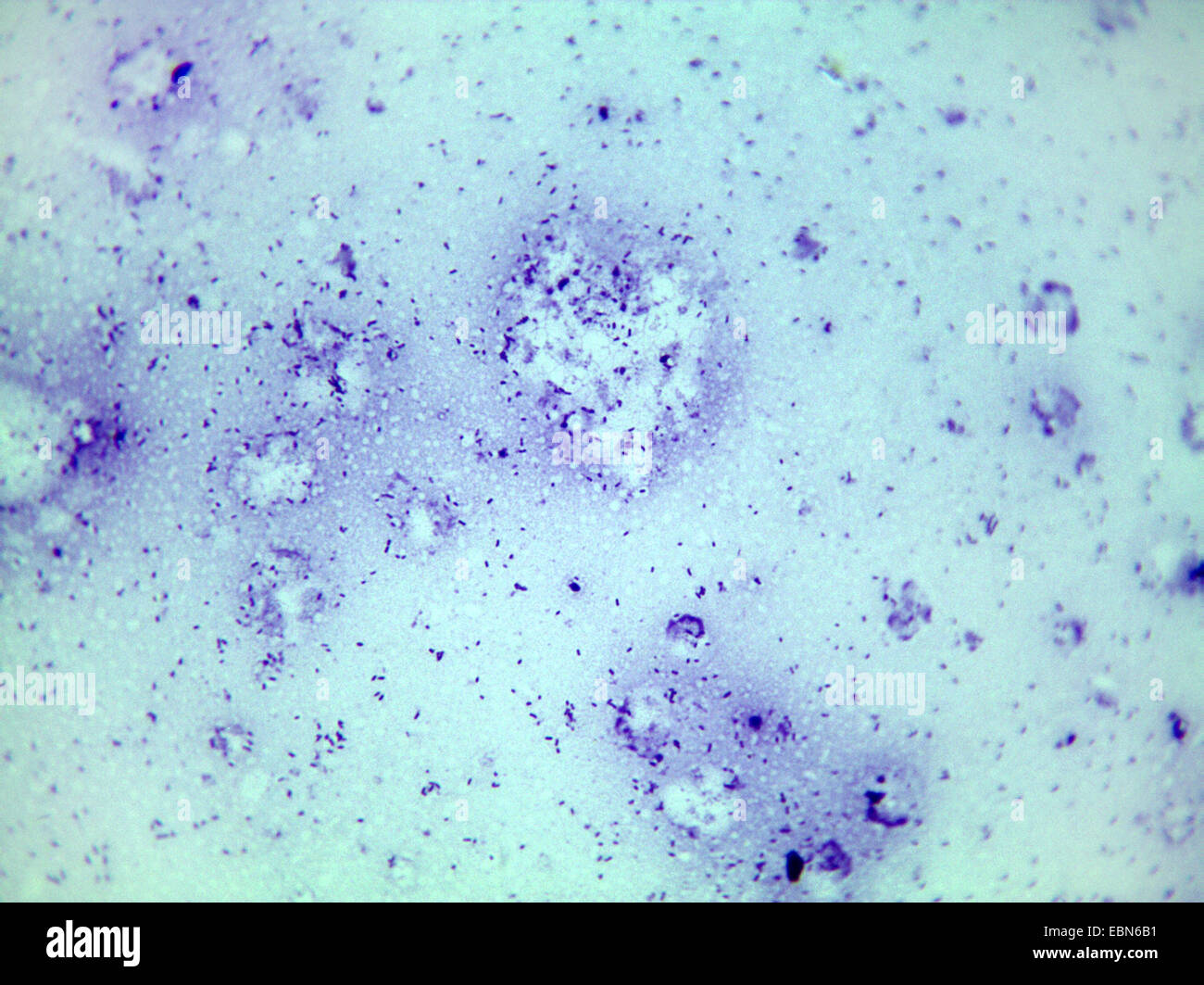 Bactérie microscope optique x Banque de photographies et d’images à ...