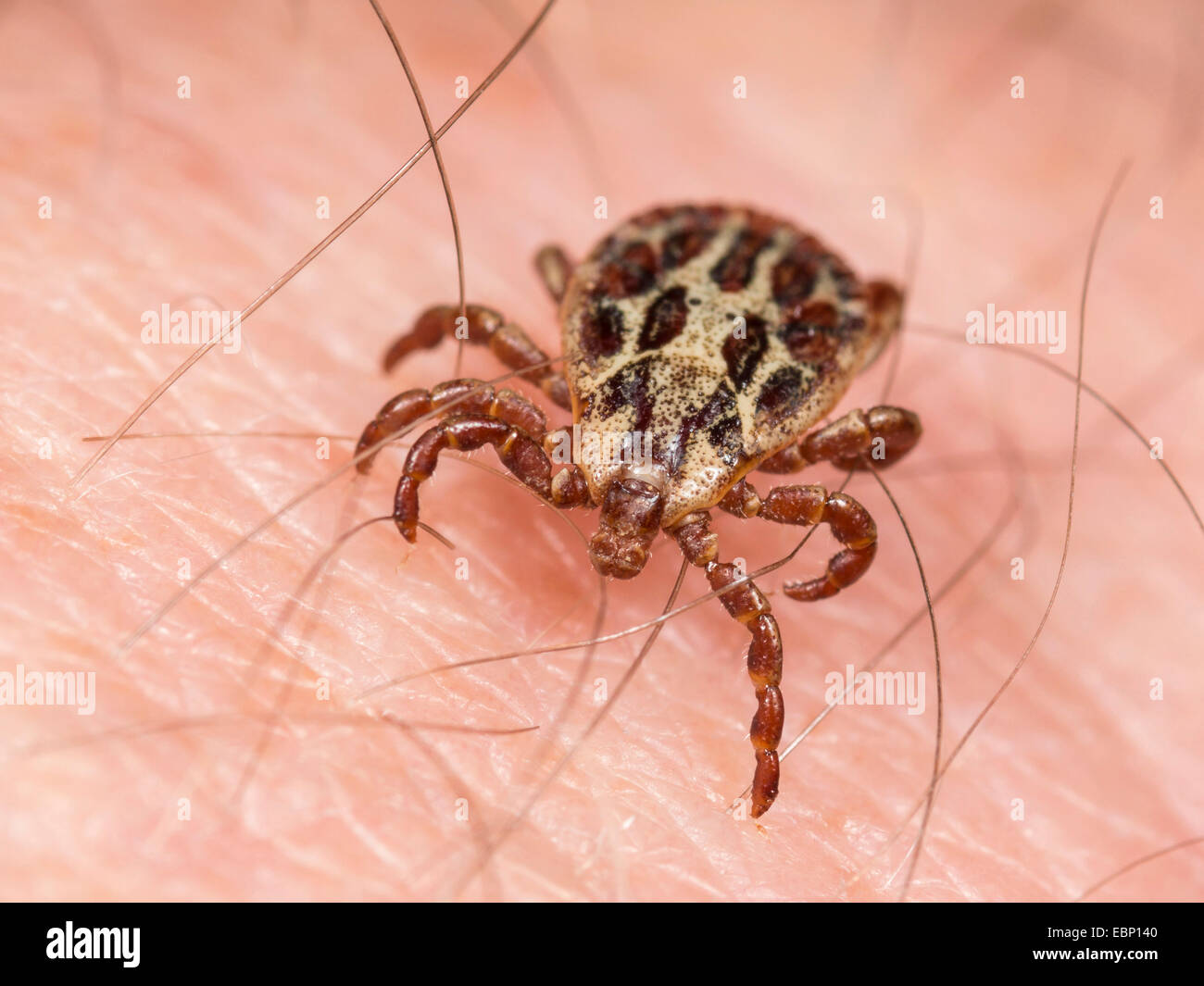 Tiques Dermacentor reticulatus (marais), homme sur la peau humaine ...