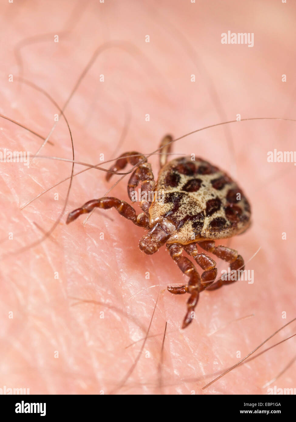 Tiques Dermacentor reticulatus (marais), homme sur la peau humaine ...