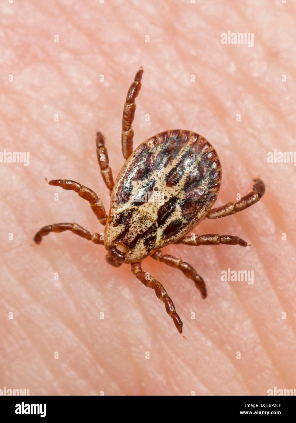 Tique sur la peau humaine Banque de photographies et d’images à haute ...