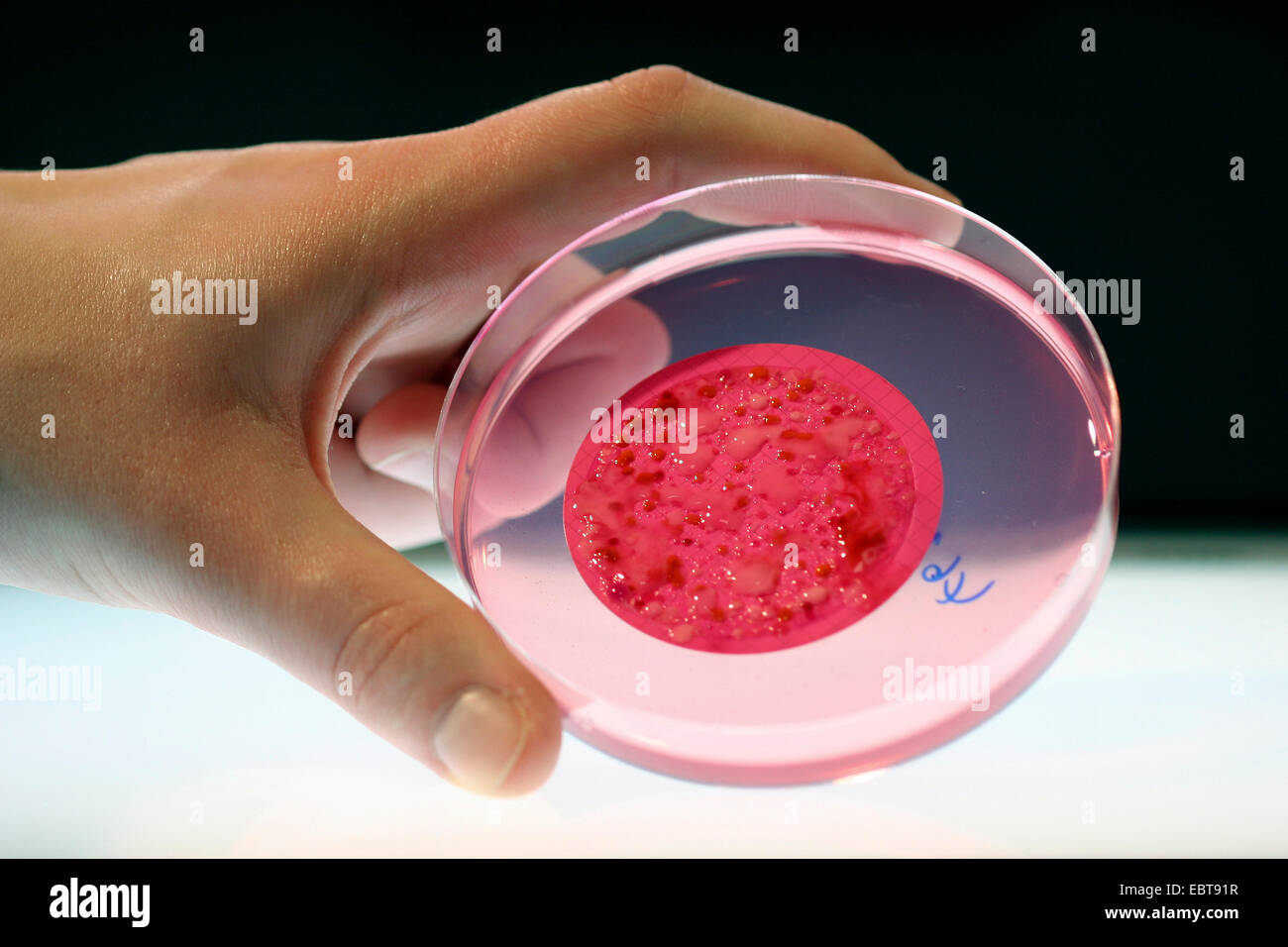 Culture bactérienne Banque de photographies et d’images à haute ...