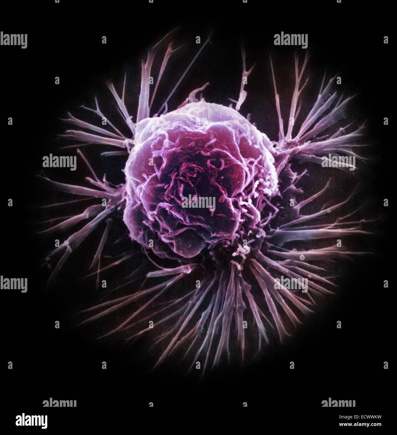 Image au microscope électronique à balayage d'une cellule de cancer du ...