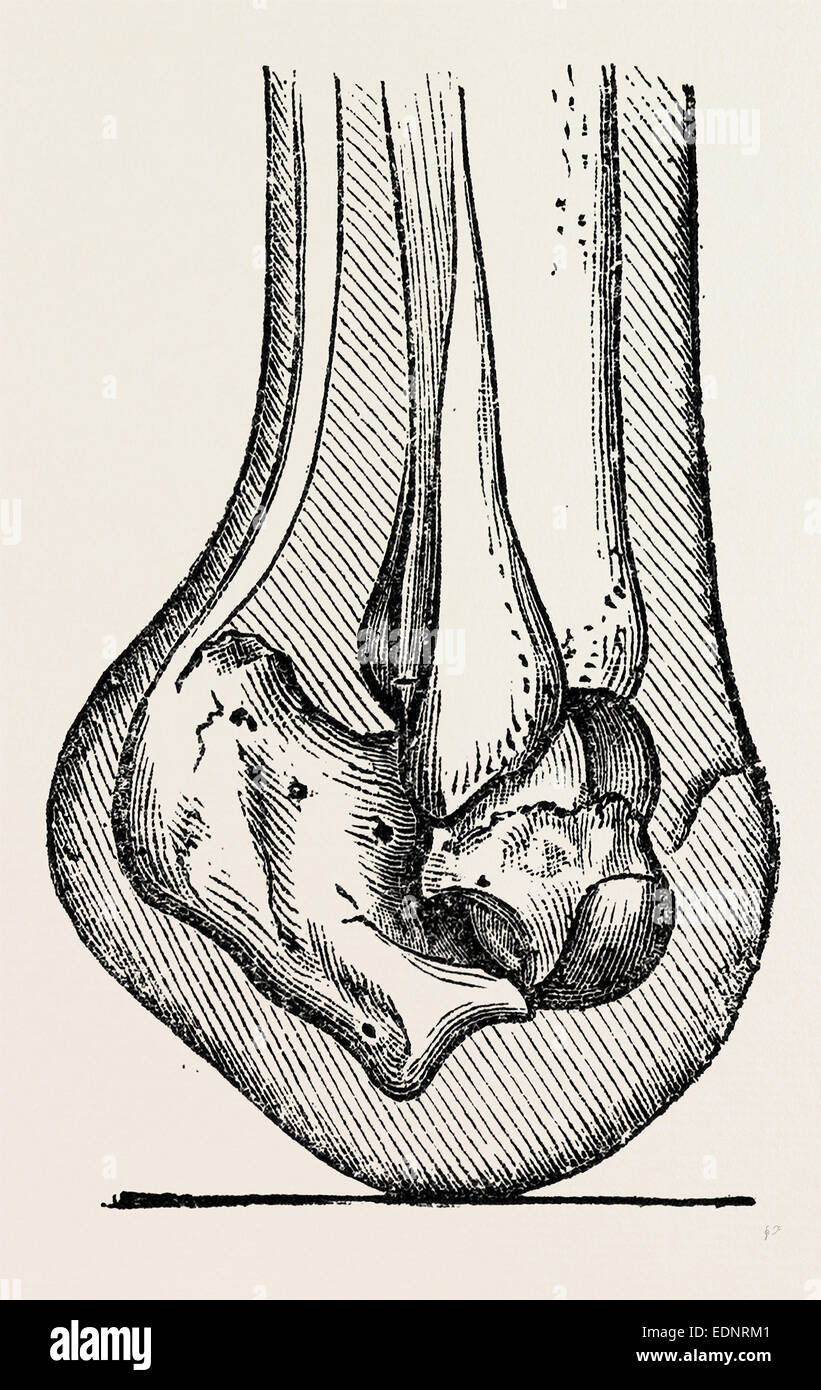 Histoire de l'anatomie Banque de photographies et d’images à haute ...