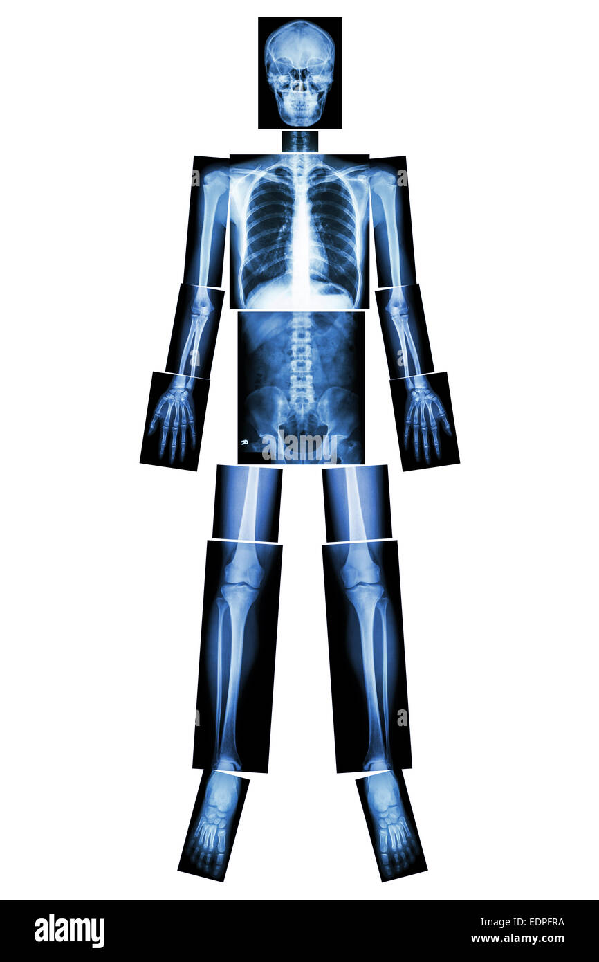 Position anatomique. (X-ray ensemble du corps : tête, cou, thorax ...