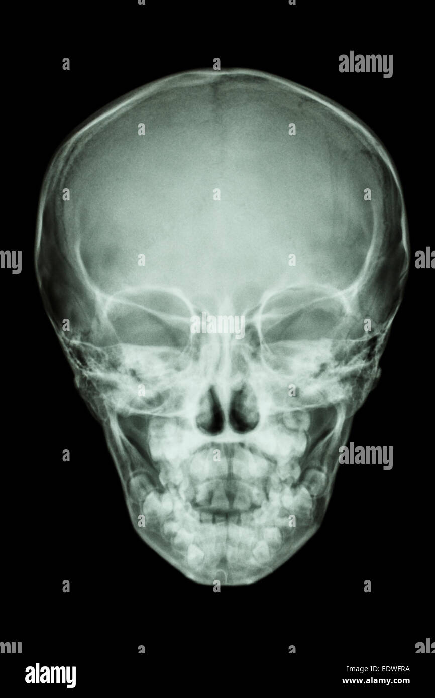 Cerveau normal enfant Banque de photographies et d’images à haute ...