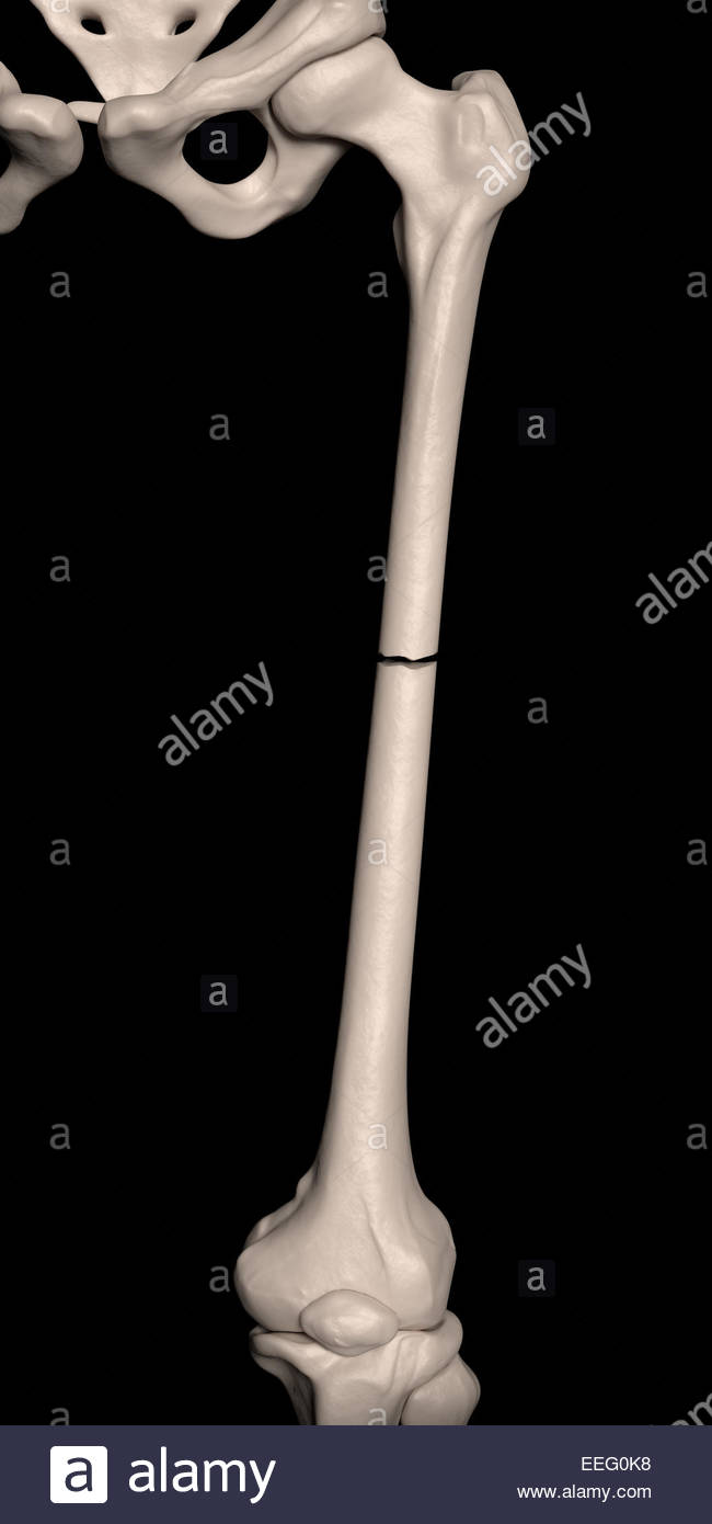 Upper Thigh Photos & Upper Thigh Images - Alamy