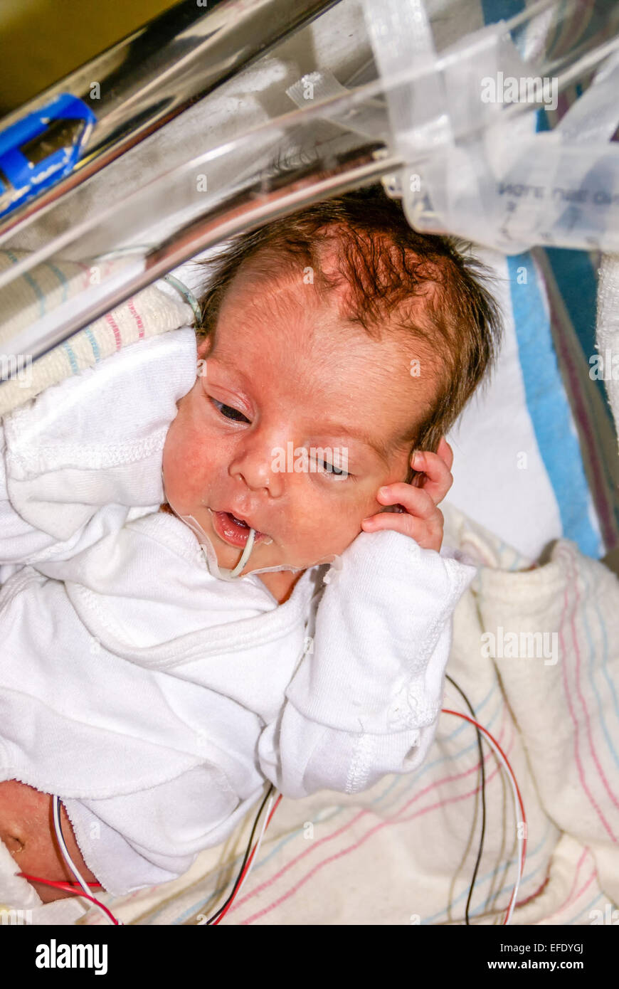Neonatal incubator Banque de photographies et d’images à haute ...