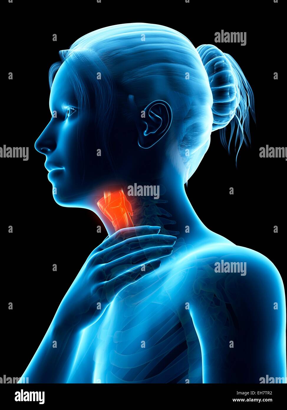 L'inflammation du larynx, illustration Photo Stock - Alamy