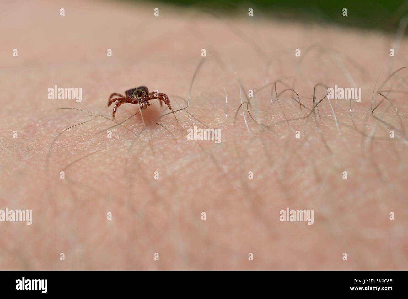 Morsure de tique sur le bras Banque de photographies et d’images à ...