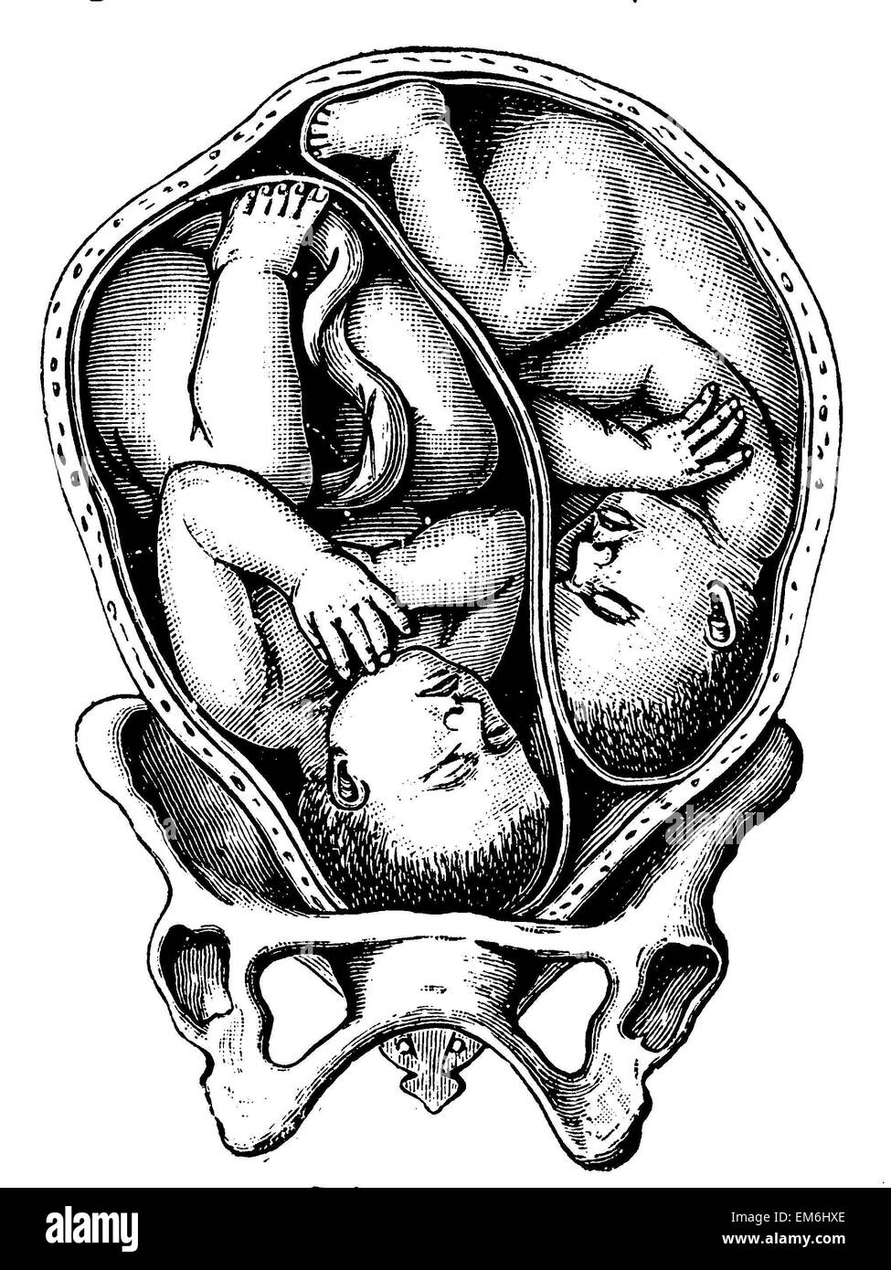 Présentation céphalique Banque de photographies et d’images à haute ...