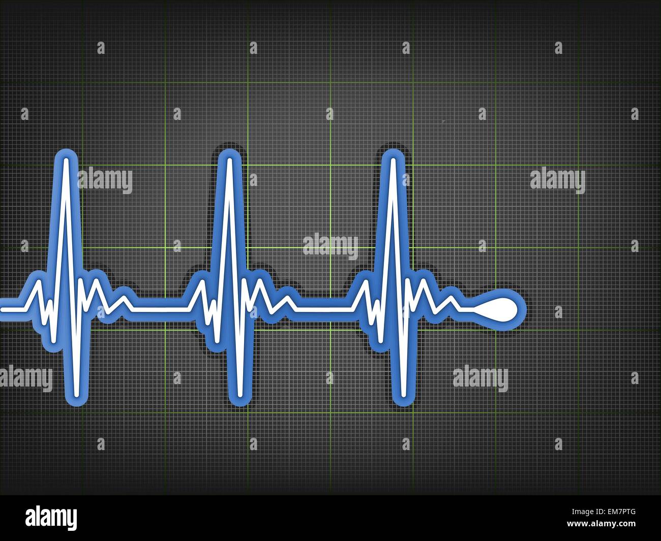 Électrocardiogramme ECG moniteur. EPS 8 Image Vectorielle Stock - Alamy