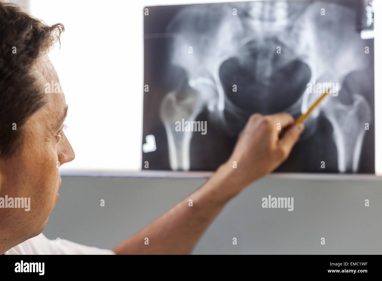 Os du bassin Banque de photographies et d’images à haute résolution - Alamy