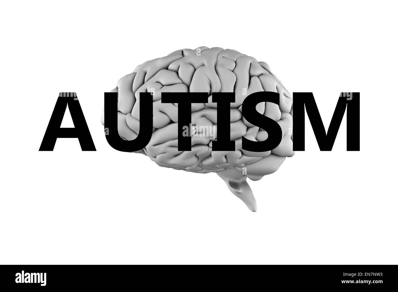 Cerveau de l'autisme Banque d'images noir et blanc - Alamy