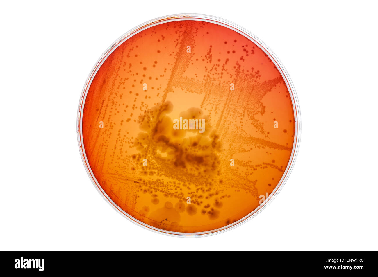 La gélose MacConkey un laboratoire de microbiologie clinique de milieu ...