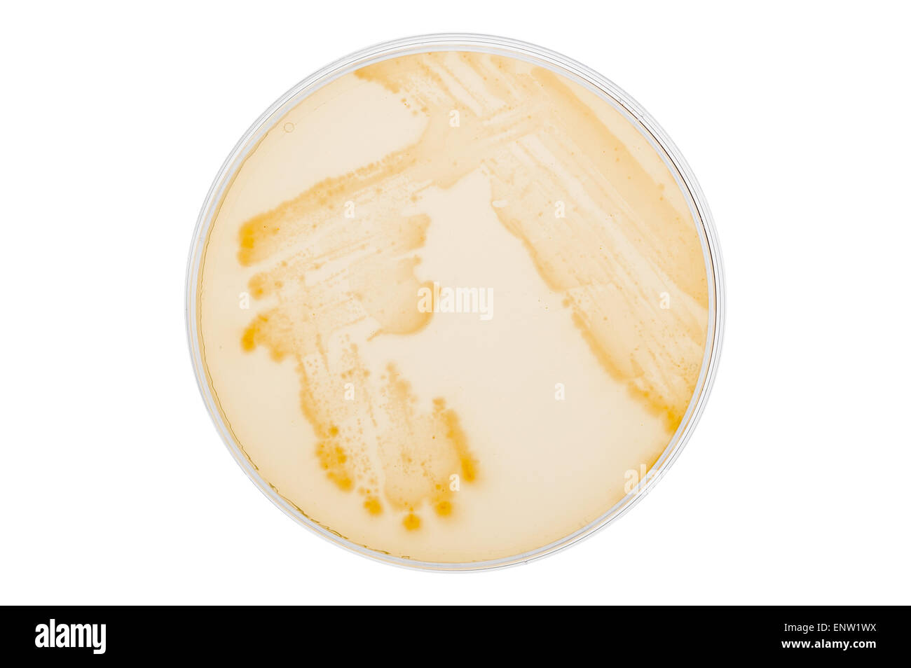 La gélose MacConkey un laboratoire de microbiologie clinique de milieu ...