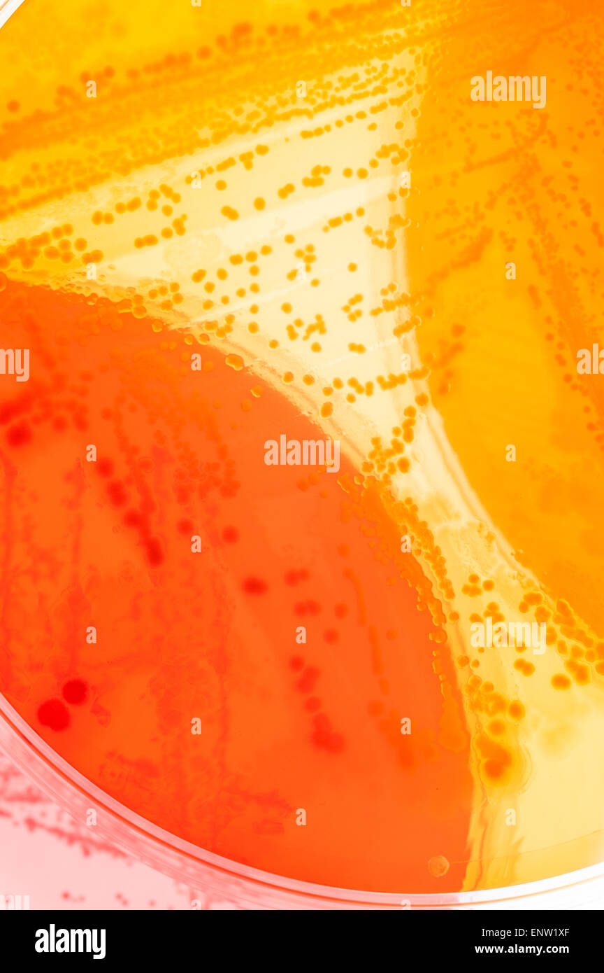 La gélose MacConkey un laboratoire de microbiologie clinique de milieu ...