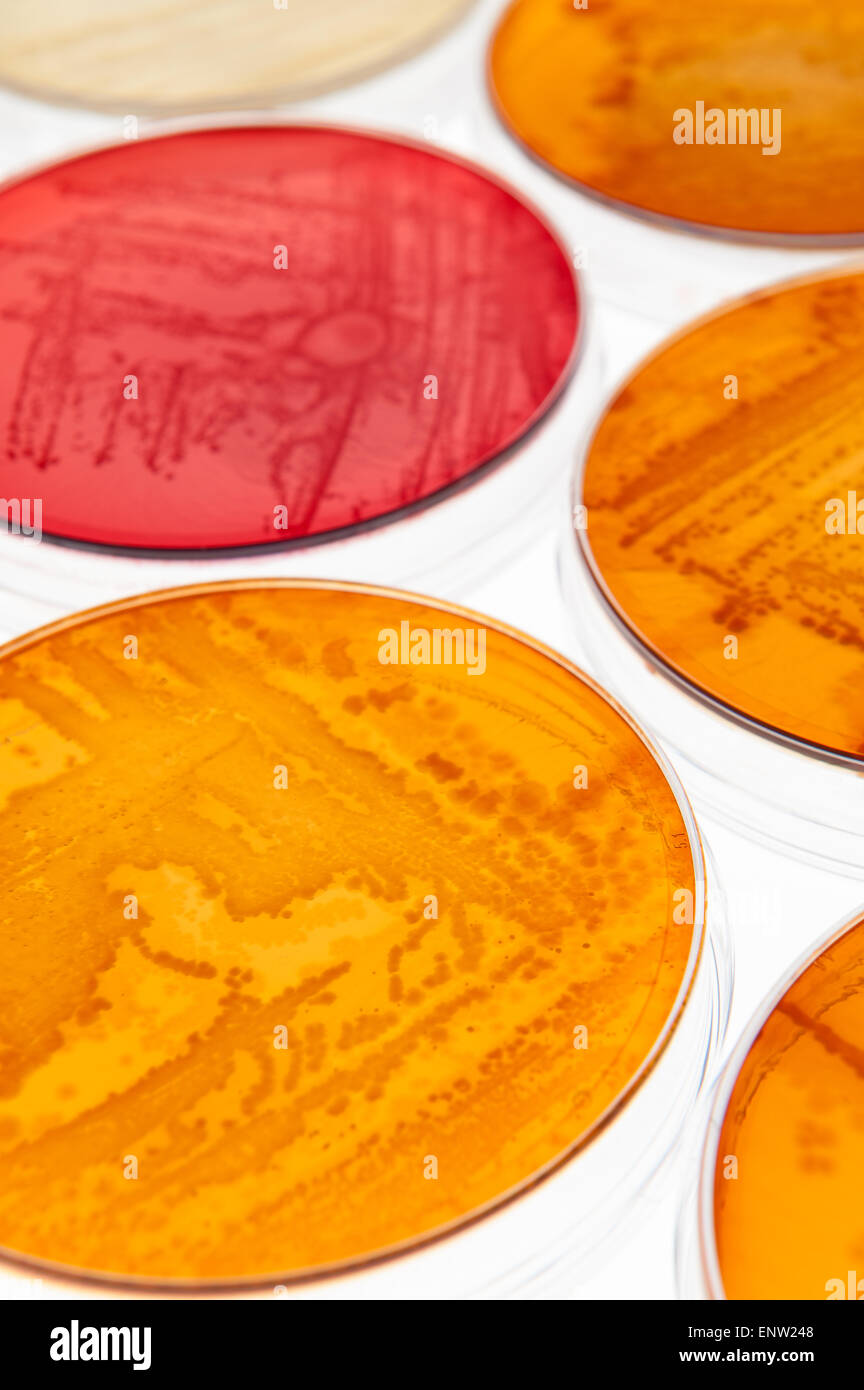 La gélose MacConkey un laboratoire de microbiologie clinique de milieu ...