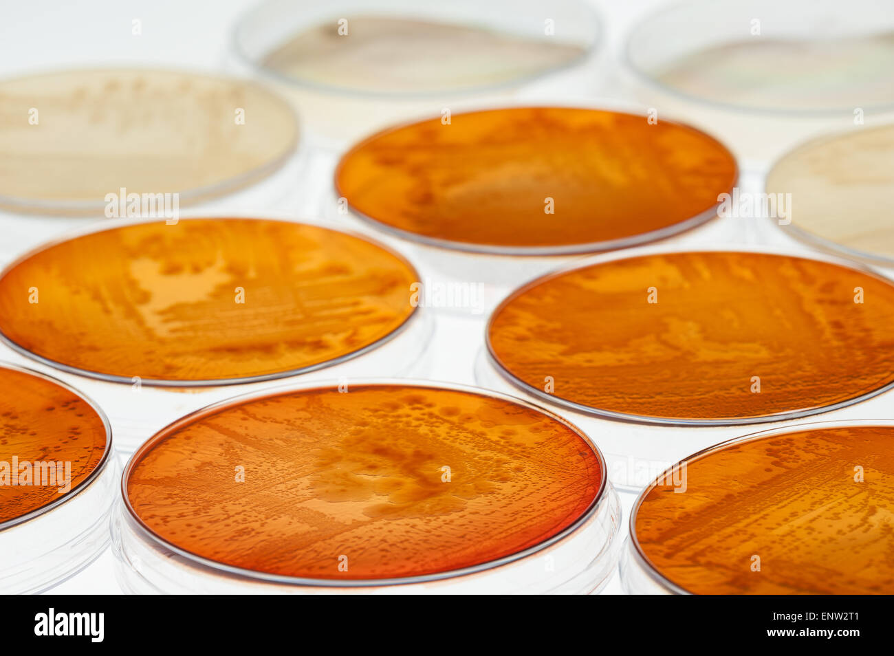 La gélose MacConkey un laboratoire de microbiologie clinique de milieu ...