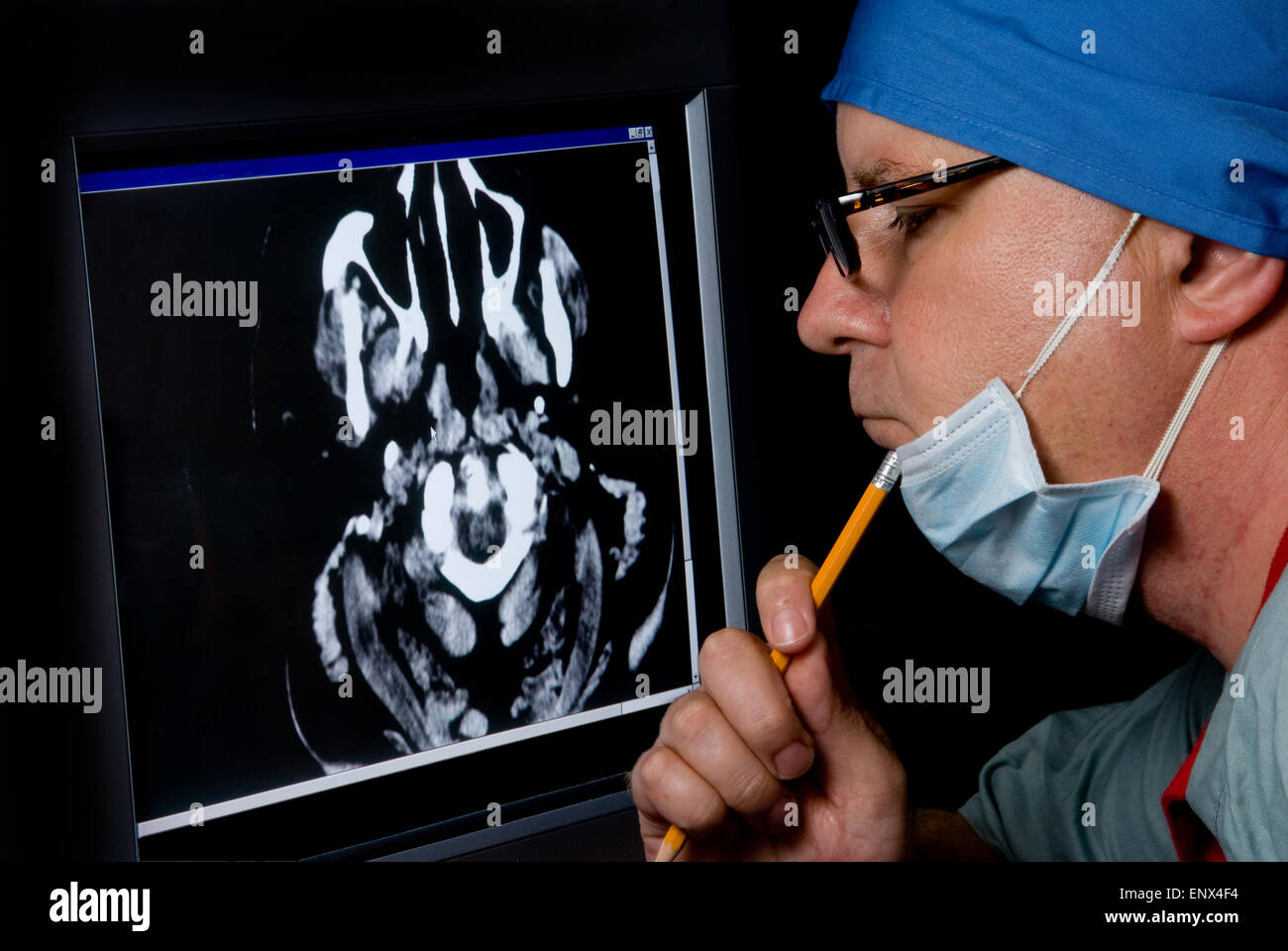 Ct scan hand Banque de photographies et d’images à haute résolution - Alamy
