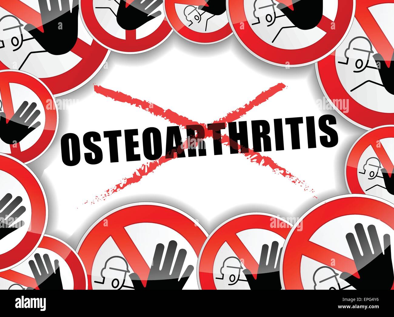Arthrose de la main Banque d'images vectorielles - Alamy