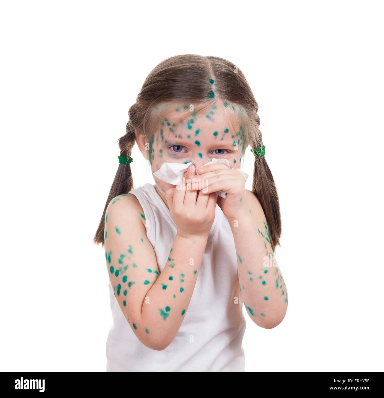 Varicelle enfant Banque de photographies et d’images à haute résolution ...